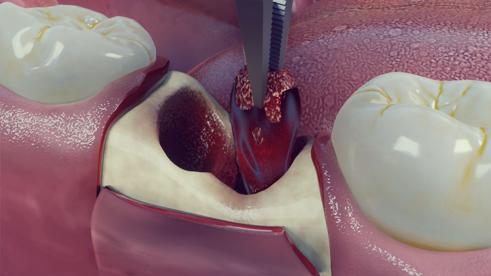 3D Medical Animations | Scientific Illustration | KHO Animation